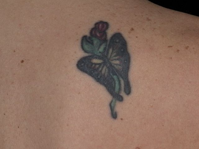 Tattoo Excision by James M. Nachbar, MD, FACS, Scottsdale, Arizona ...